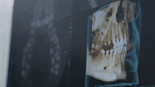 What are CBCT Dental X-Rays? | Dental Imaging in Wilkes-Barre